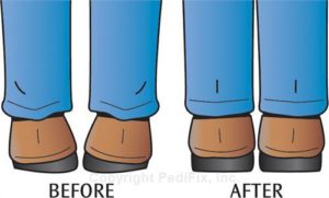 Foot care:Heel Straights